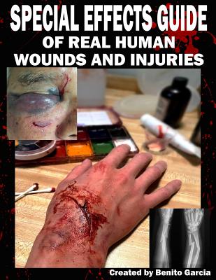 Special Effects Guide Of Real Human Wounds and Injuries: Special ...